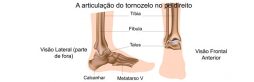 Fratura, tratamento, CID, fisioterapia, tudo, tudo sobre a lesão