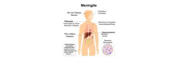 Entenda a Meningite e Como Funciona o Tratamento Fisioterapêutico