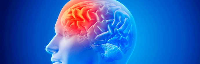 Tudo que Você precisa Saber sobre Síndrome Pós-Pólio