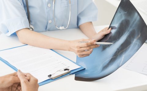 Pneumoconiose: o que é, sintomas, diagnóstico e tratamento da doença